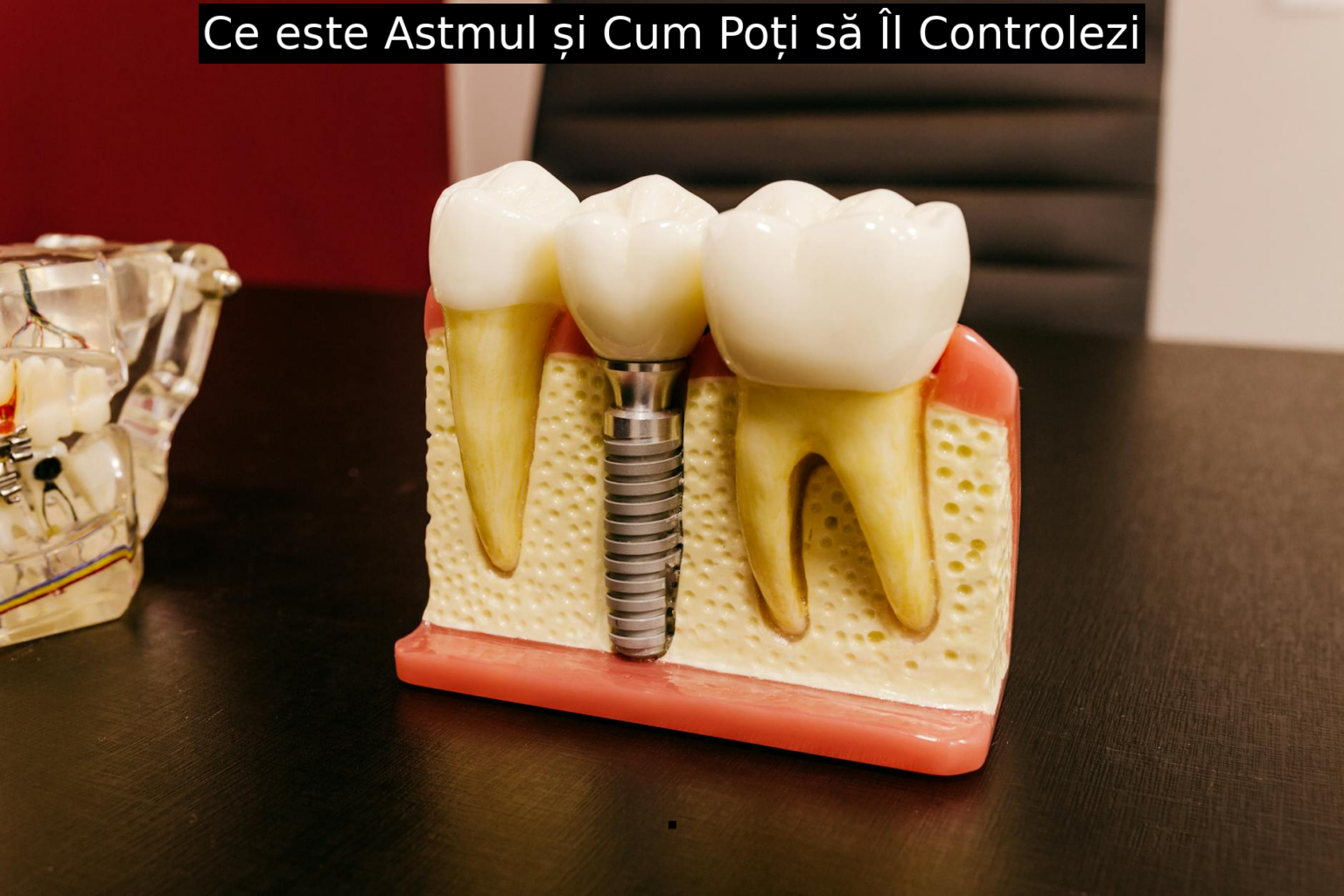 sinufen: prospect, informatii, mod de administrare, reactii adverse ...